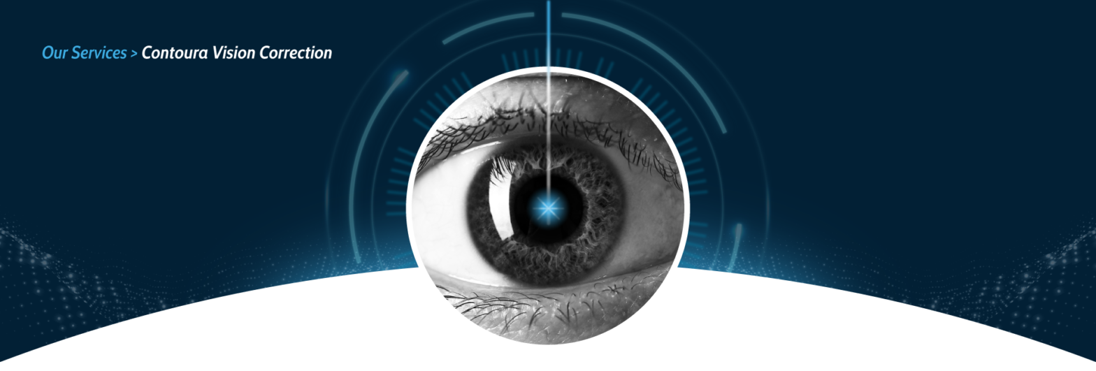 Contoura Vision Correction - Cure Sight Laser Center